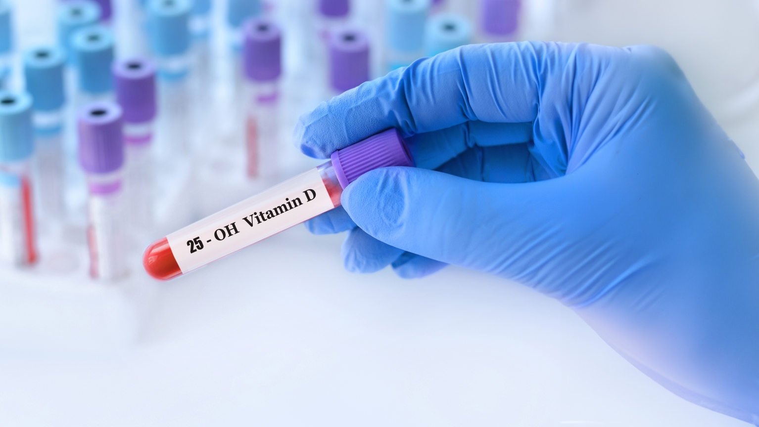 Diagnostic and therapeutic Management of vit D deficiency | Default